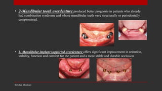 single denture kelly syndrome.pdf