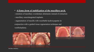 single denture kelly syndrome.pdf