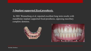 single denture kelly syndrome.pdf