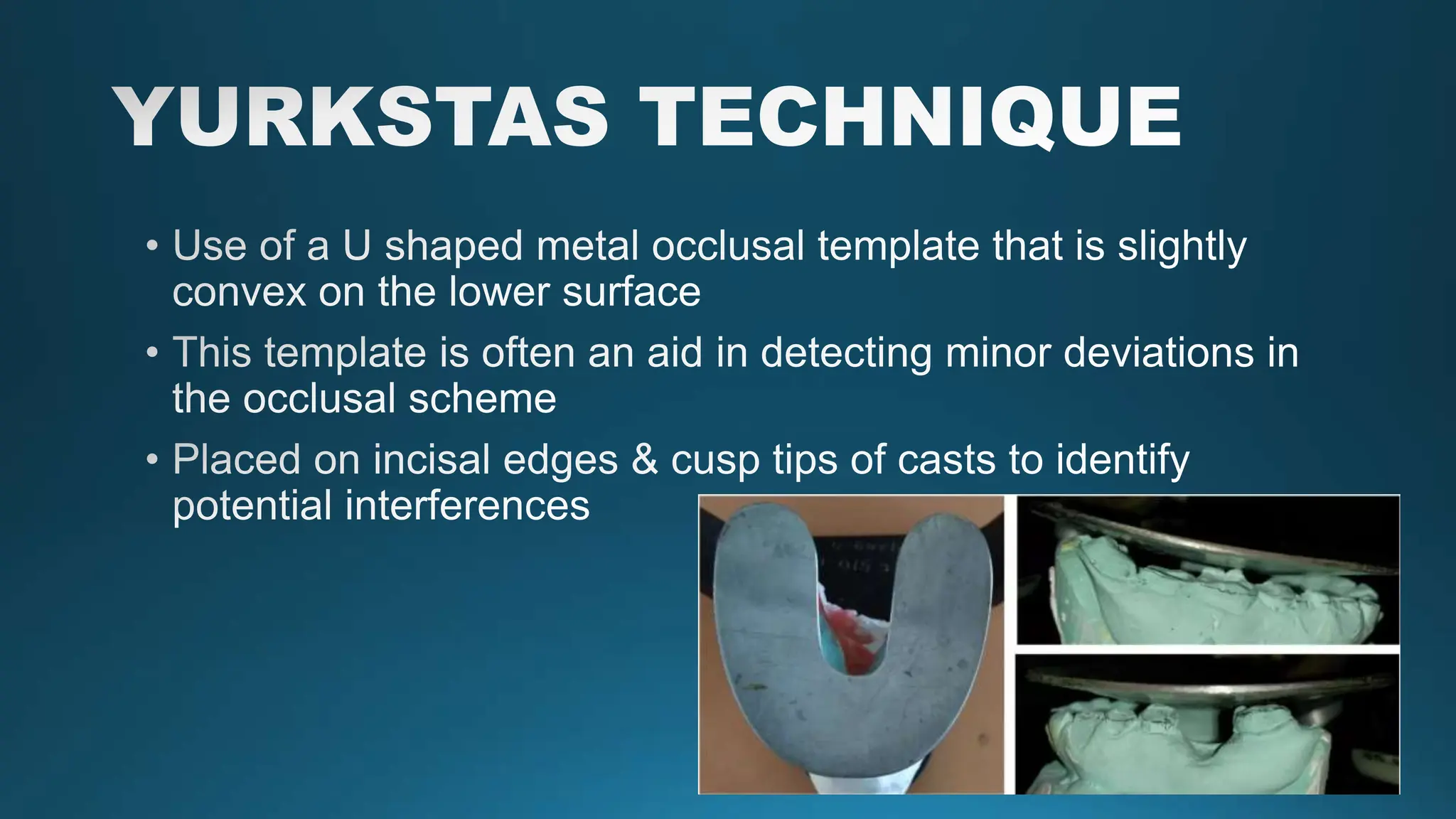 SINGLE MAXILLARY DENTURE AND ITS MANAGEMENT | PPTX