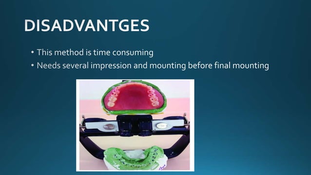SINGLE MAXILLARY DENTURE AND ITS MANAGEMENT | PPT
