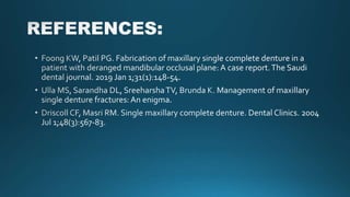 SINGLE MAXILLARY DENTURE AND ITS MANAGEMENT | PPTX