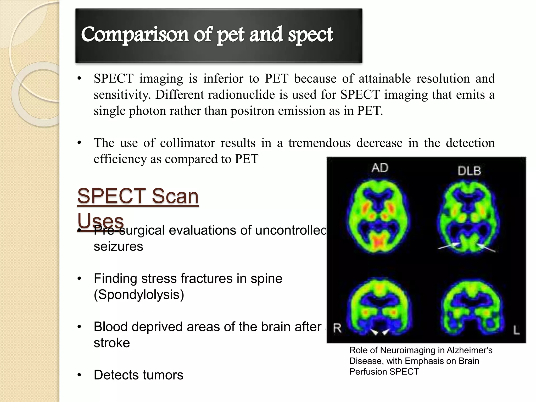 Single photon emission computed tomography (spect) | PPTX