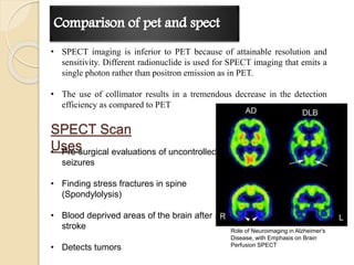 Single photon emission computed tomography (spect) | PPTX