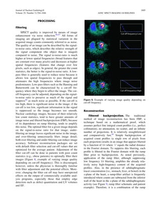 Single photon emission computed tomography spect | PDF