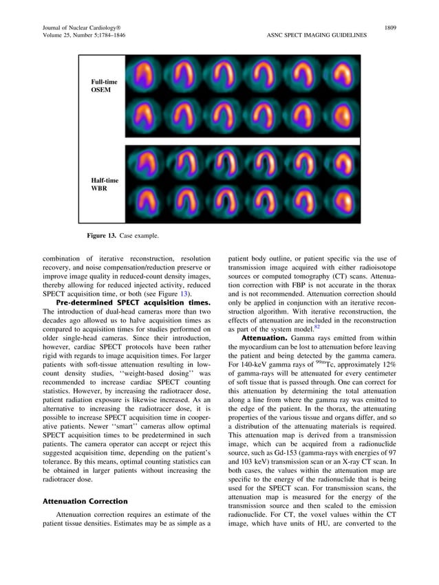 Single photon emission computed tomography spect | PDF