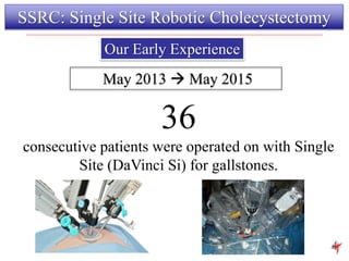 Single site cholecystectomy | PPT