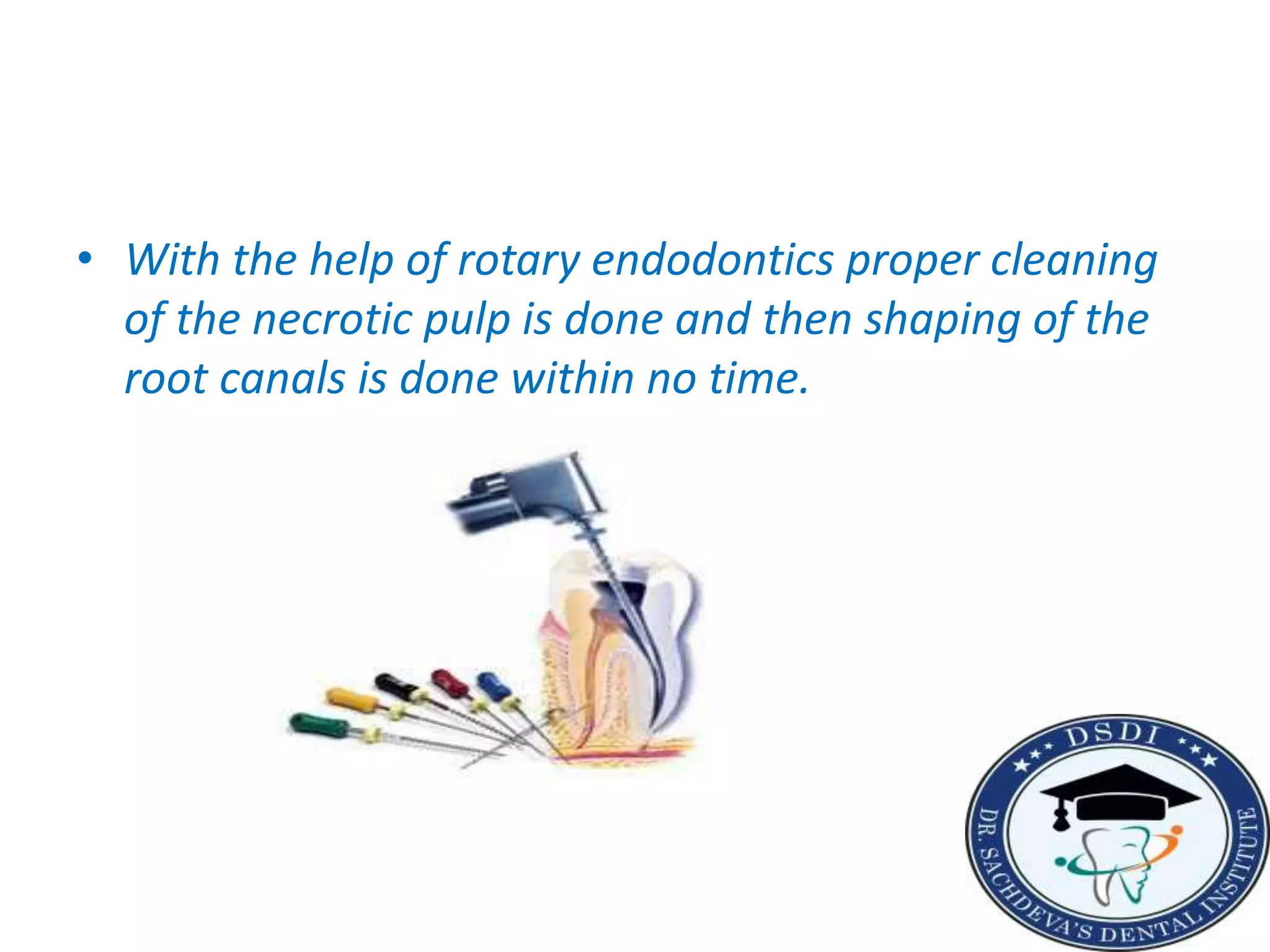 Single sitting root canal treatment. | PPTX