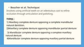 Single special denture a type of complete denture | PPT