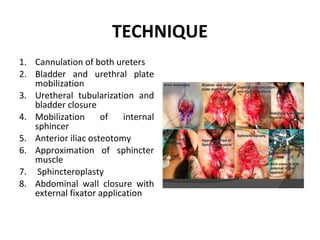 Single stage complete_bladder_extrophy_repair_in_both | PPT