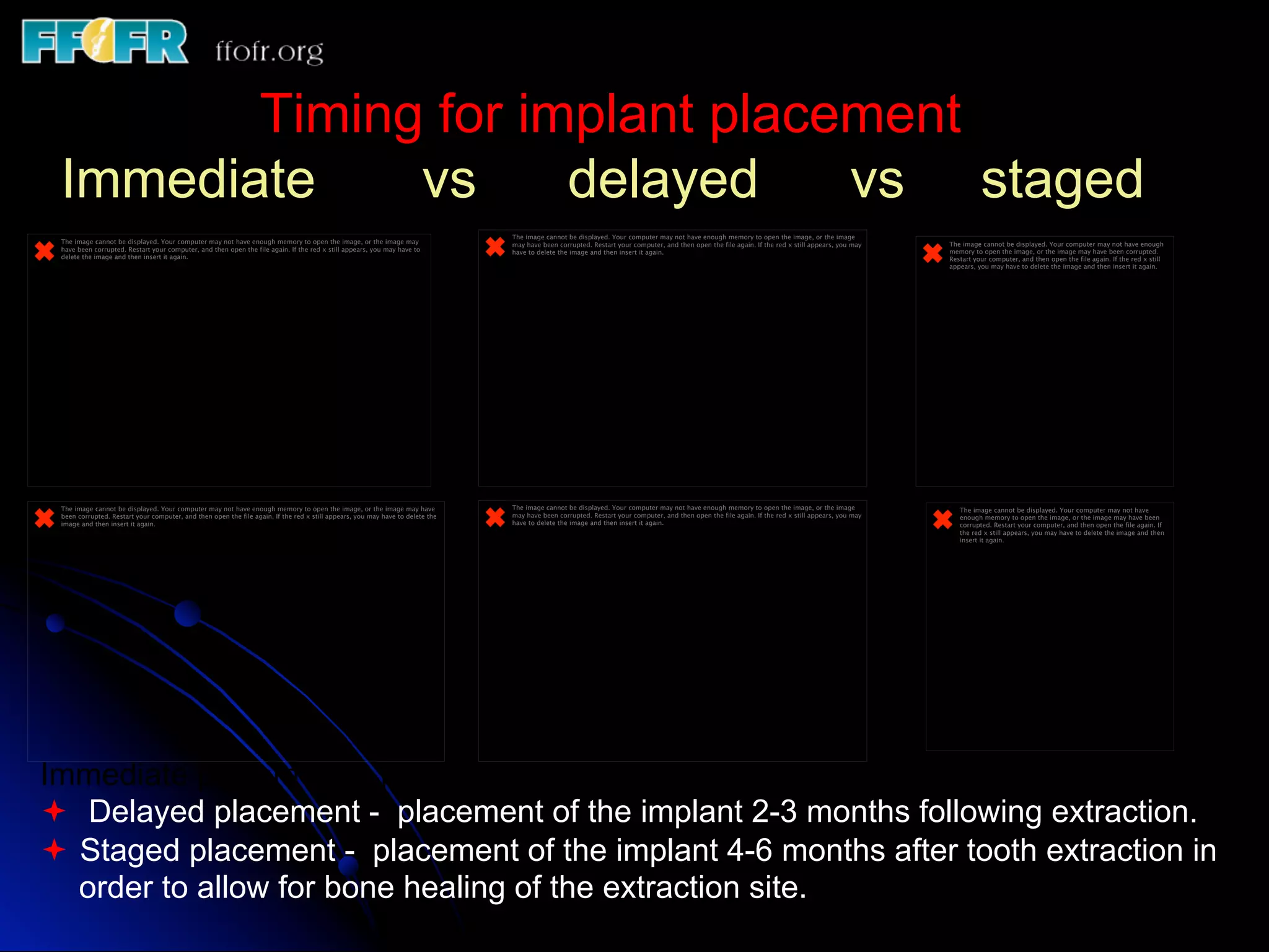 Single tooth defects in the posterior quadrants | PPT
