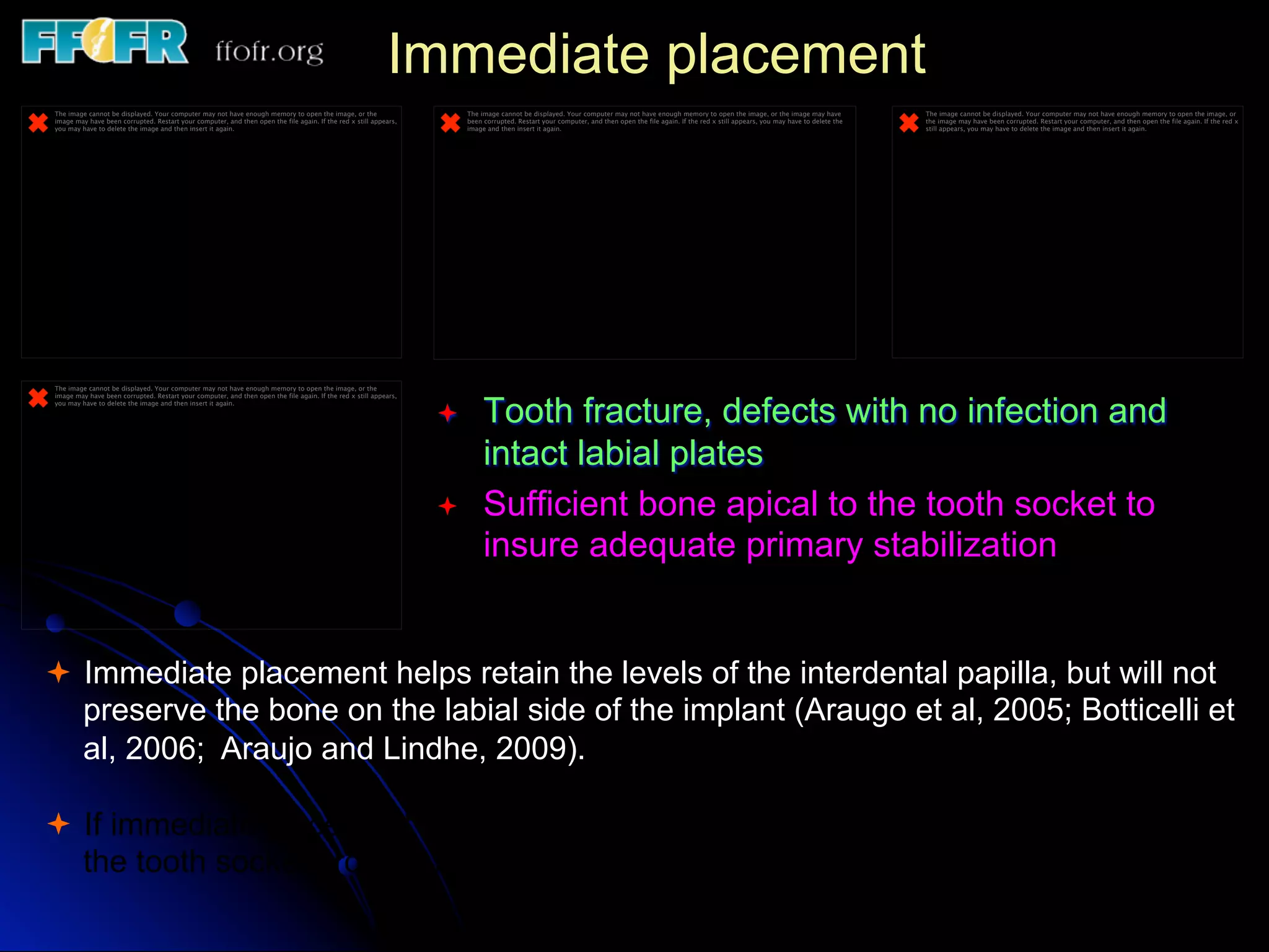 Single tooth defects in the posterior quadrants | PPT