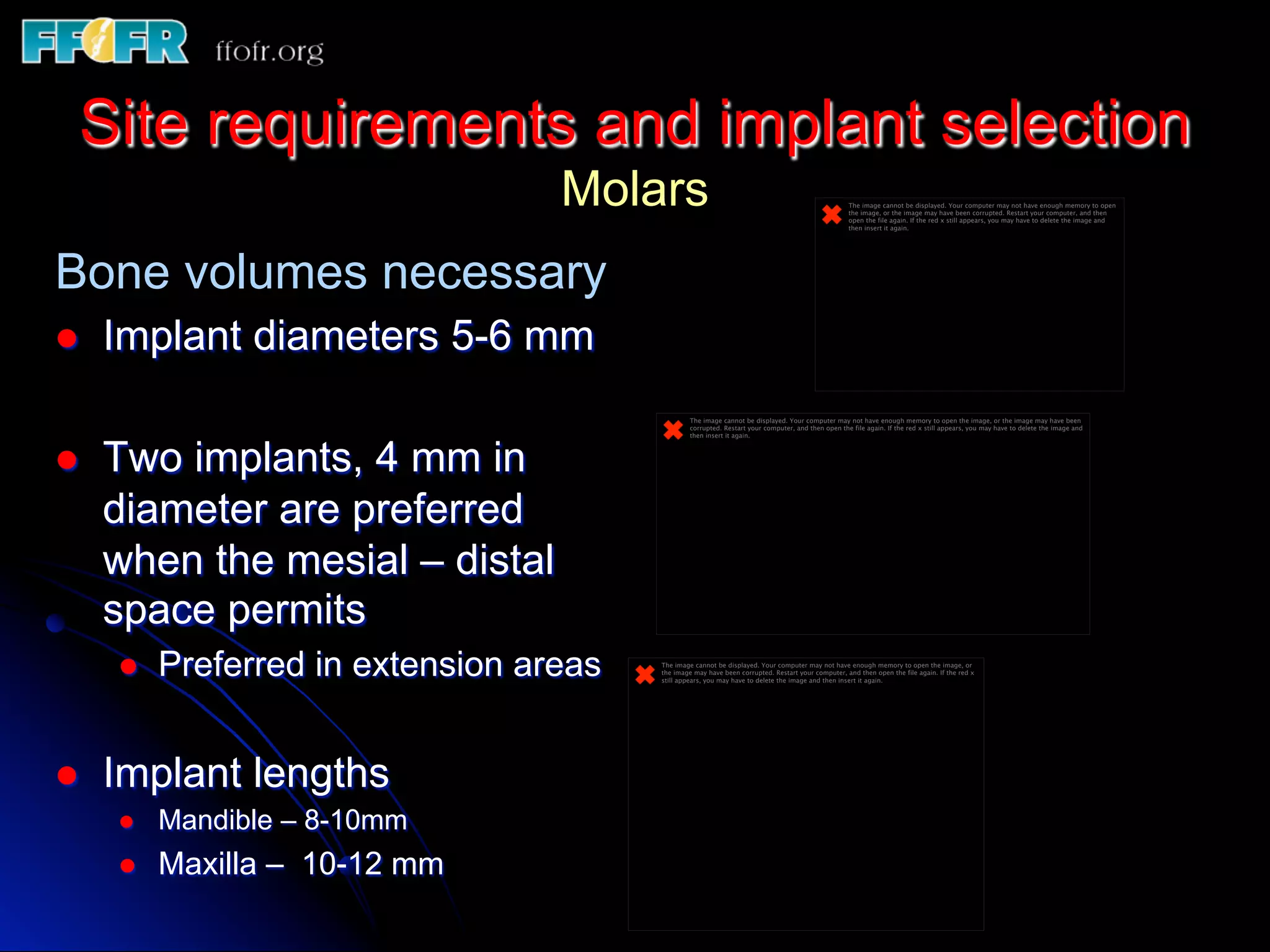 Single tooth defects in the posterior quadrants | PPT