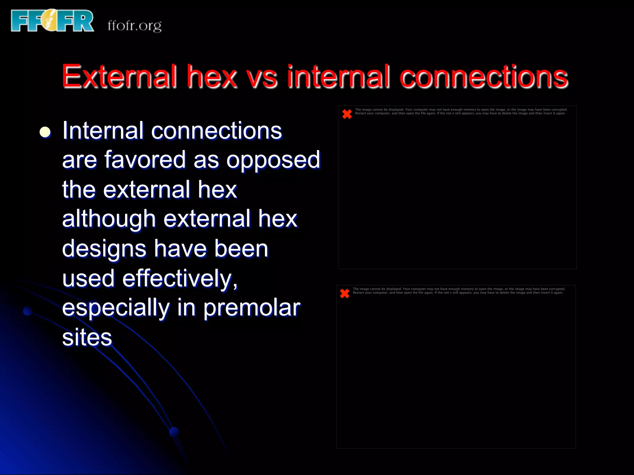 Single tooth defects in the posterior quadrants | PPT