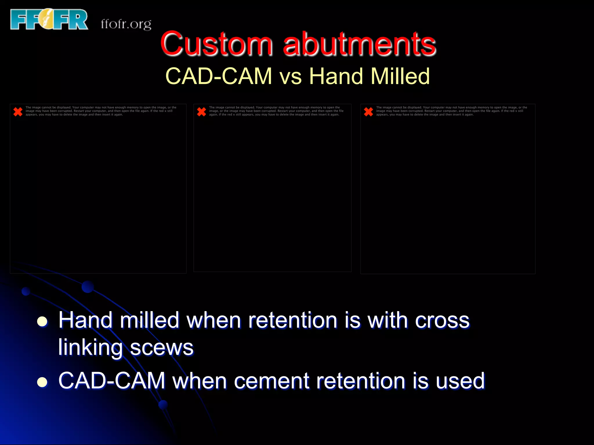 Single tooth defects in the posterior quadrants | PPT