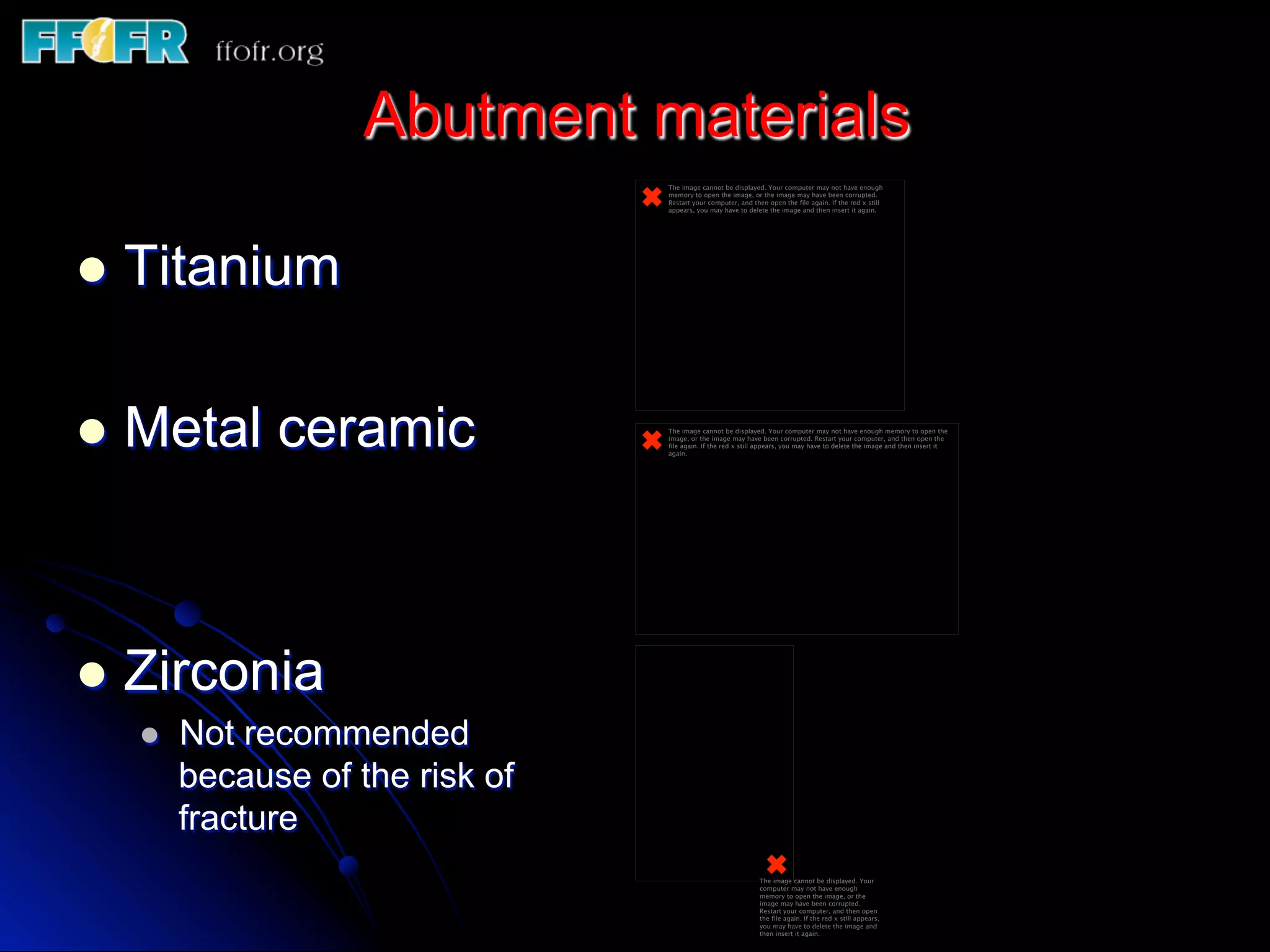 Single tooth defects in the posterior quadrants | PPT
