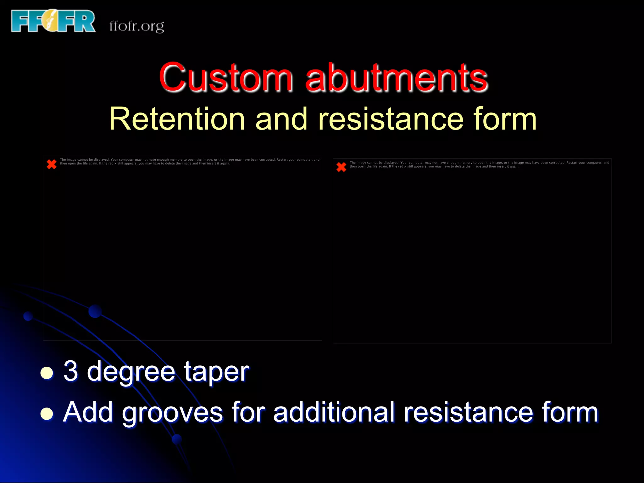 Single tooth defects in the posterior quadrants | PPT