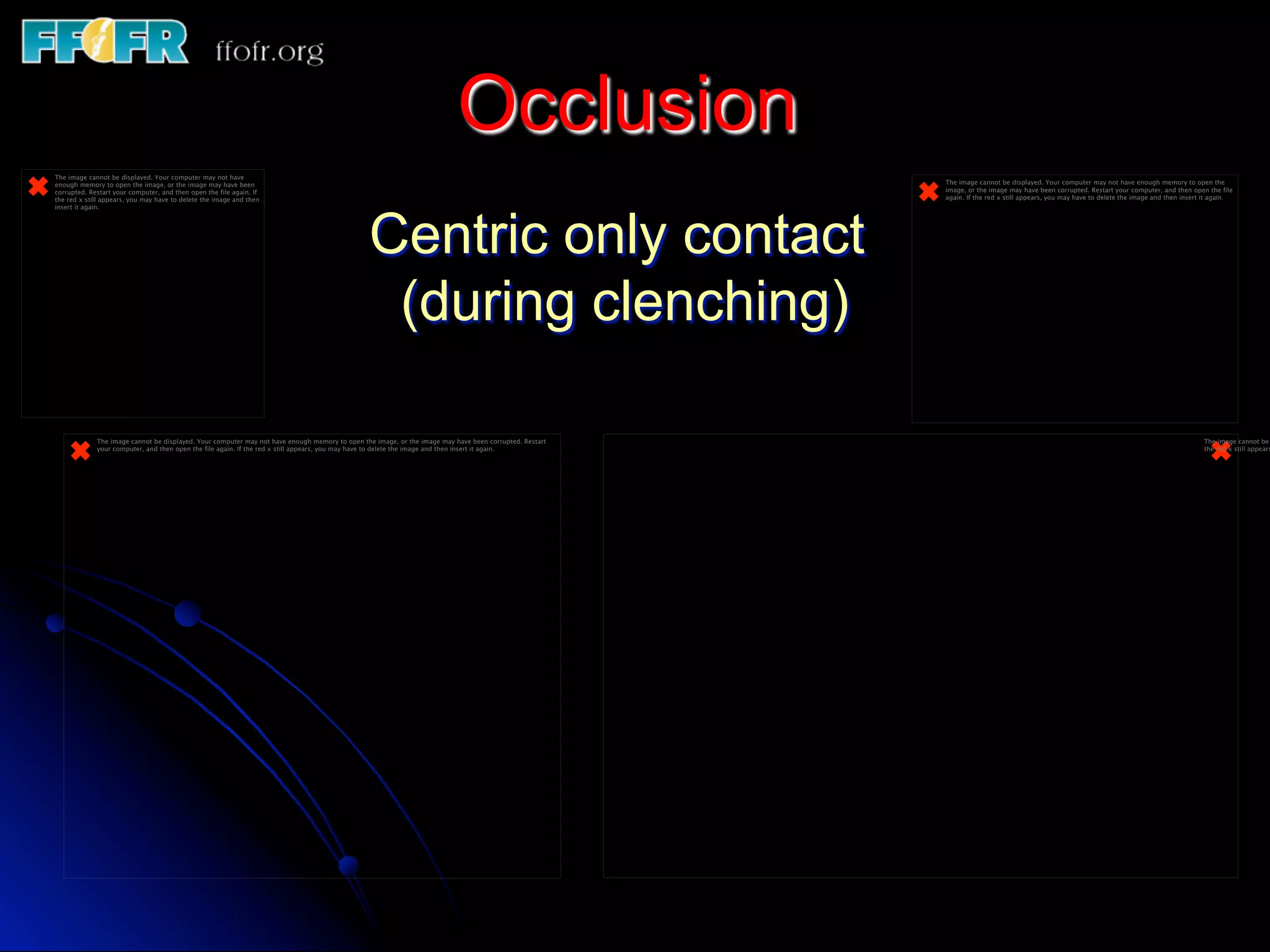 Single tooth defects in the posterior quadrants | PPT