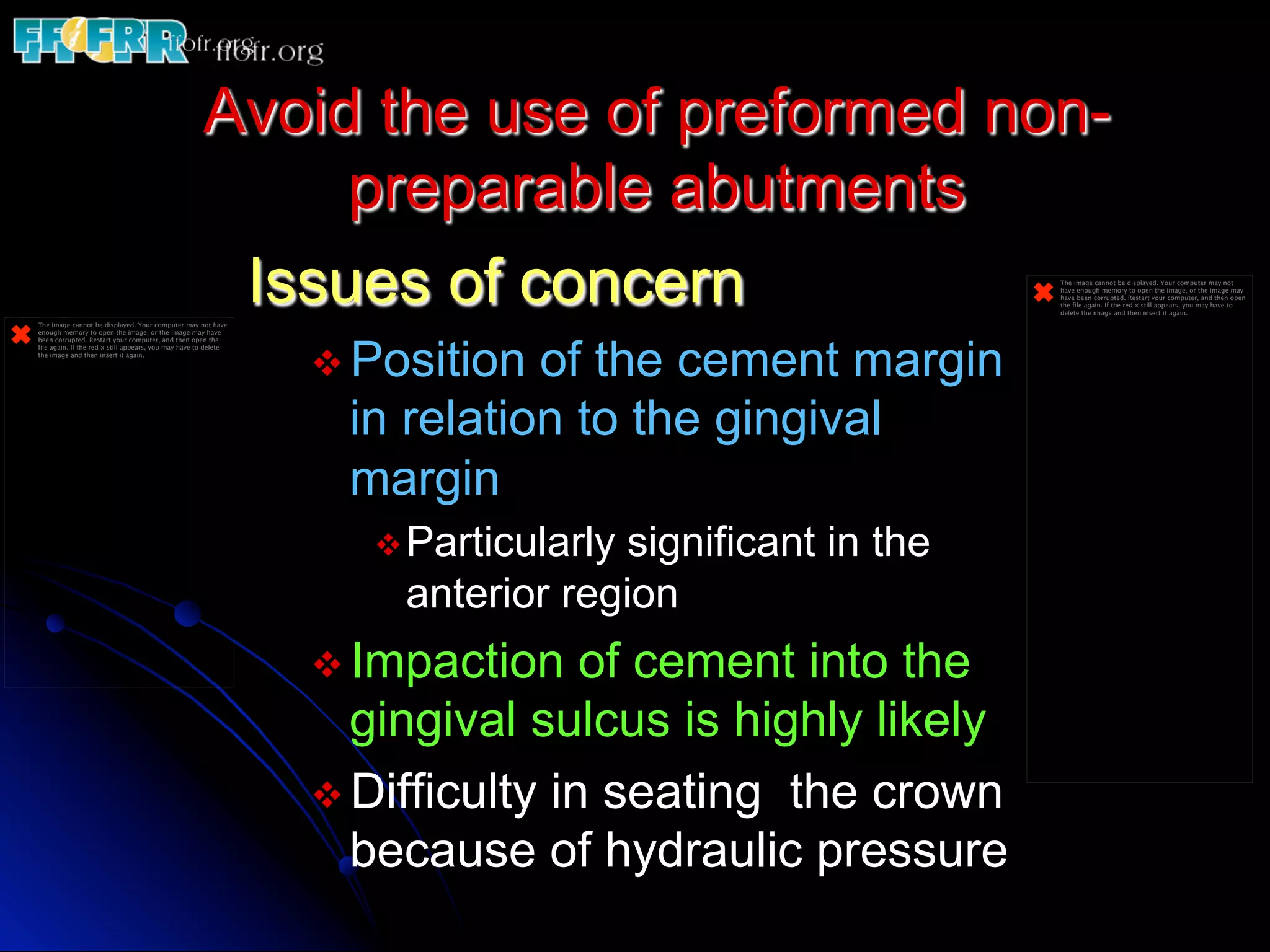 Single tooth defects in the posterior quadrants | PPT