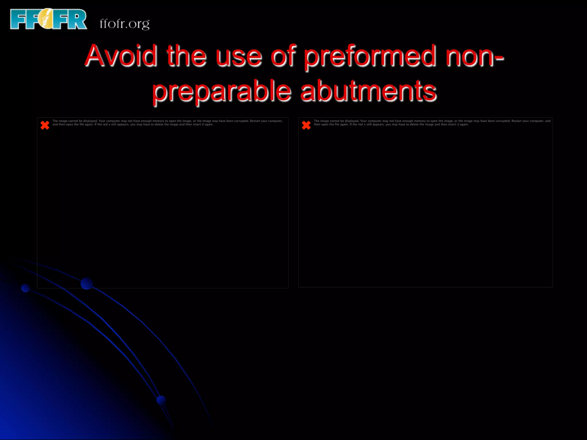 Single tooth defects in the posterior quadrants | PPT