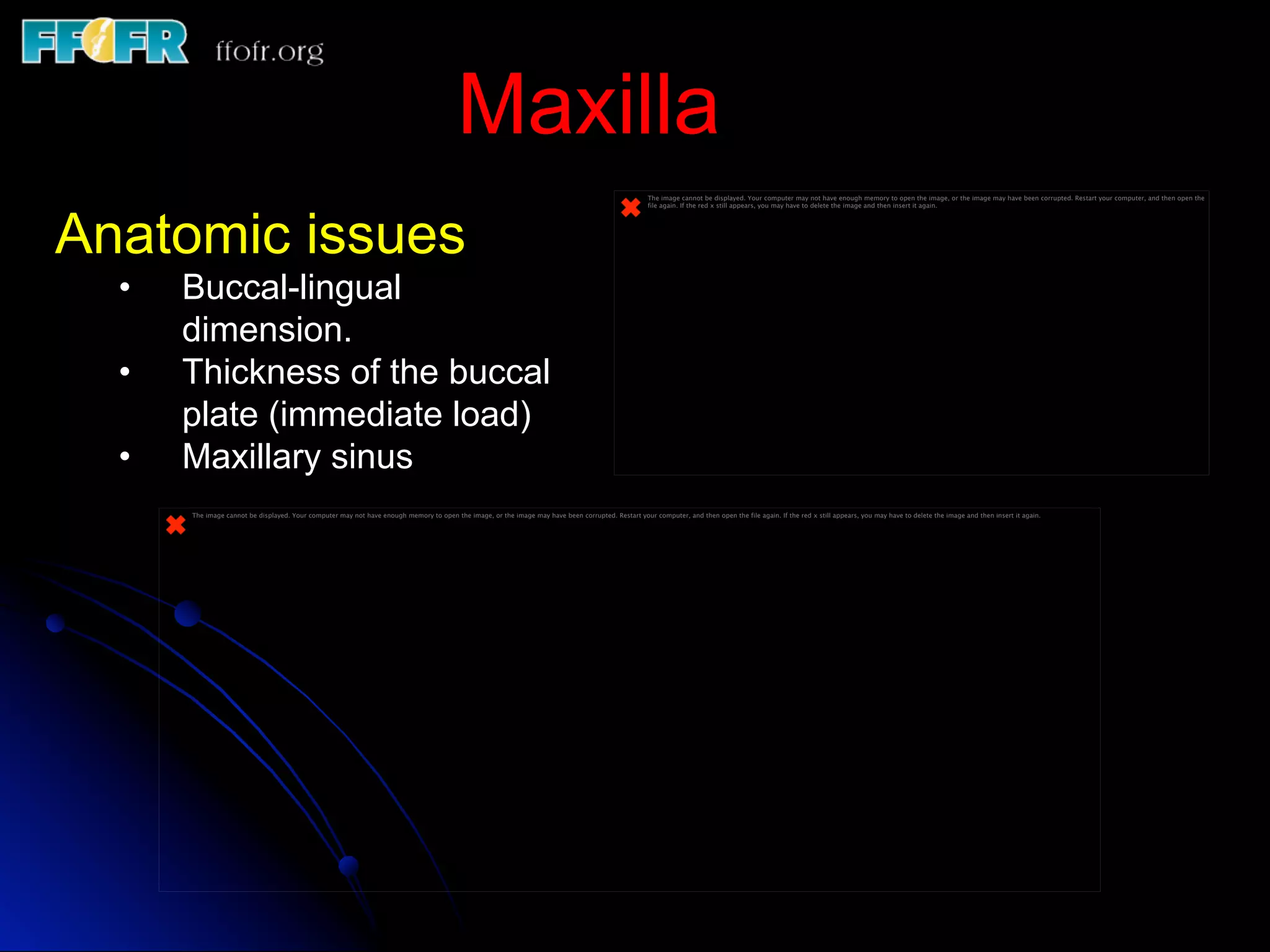 Single tooth defects in the posterior quadrants | PPT