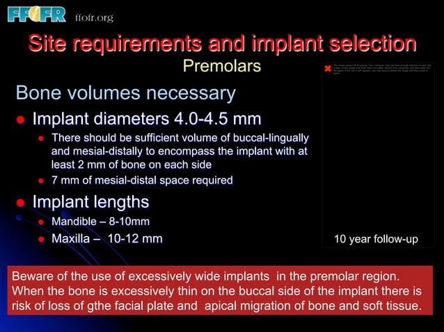 Single tooth defects in the posterior quadrants | PPT