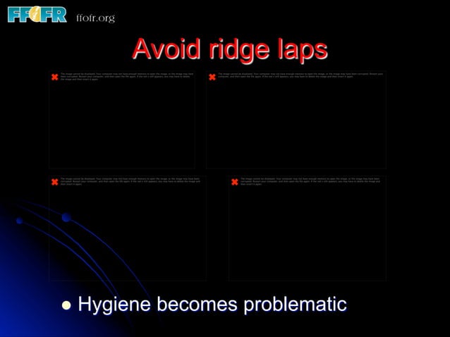 Single tooth defects in the posterior quadrants | PPT
