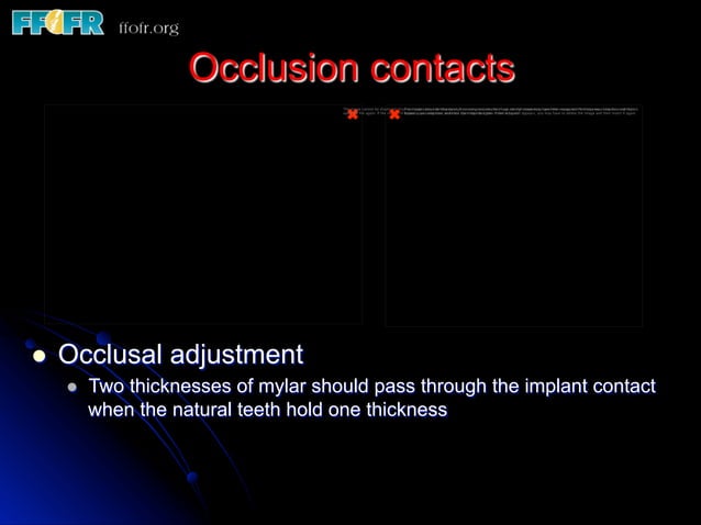 Single tooth defects in the posterior quadrants | PPT