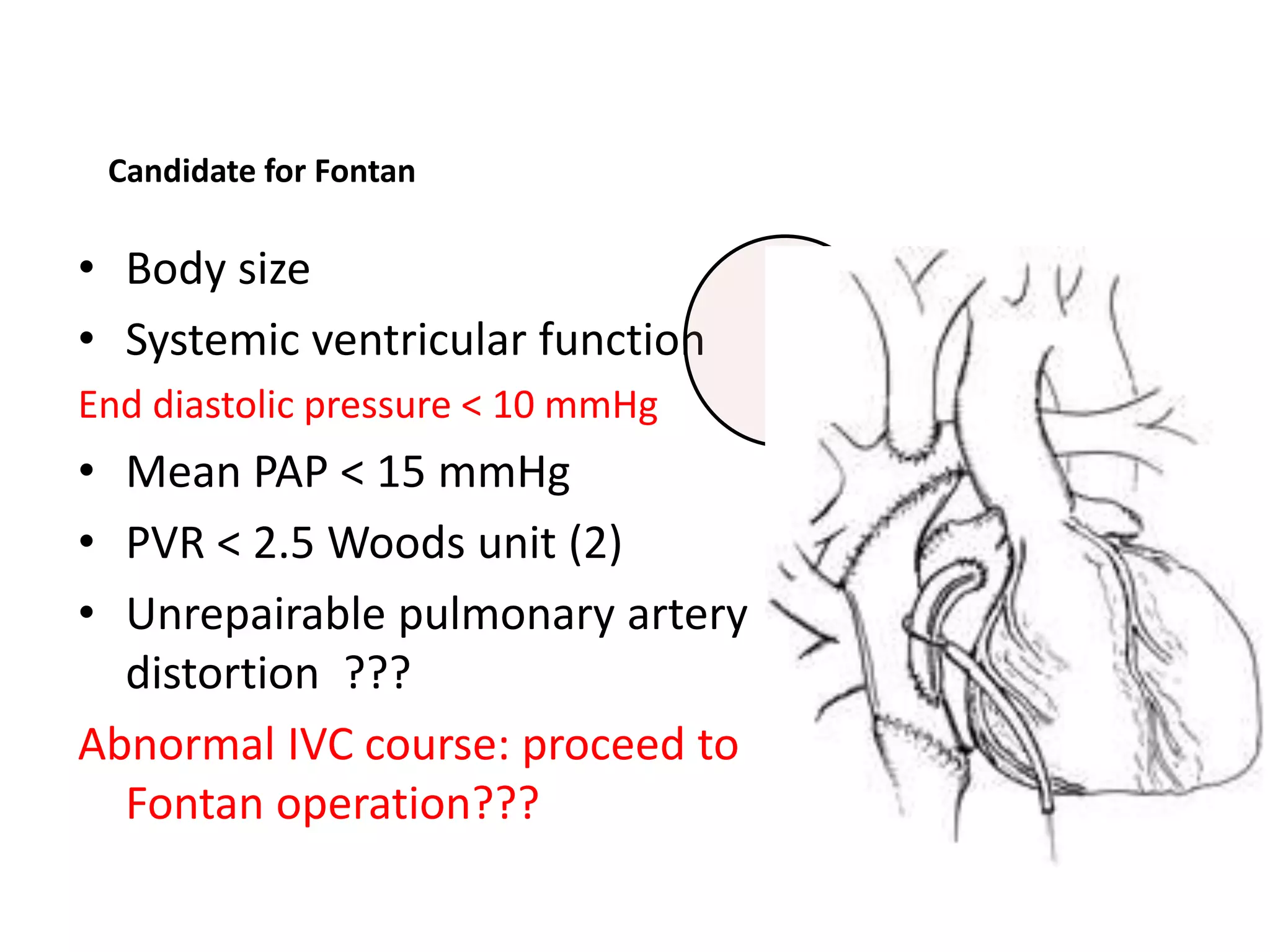 Single ventricle | PPTX