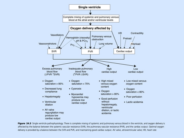 single ventricle physiology | PPT