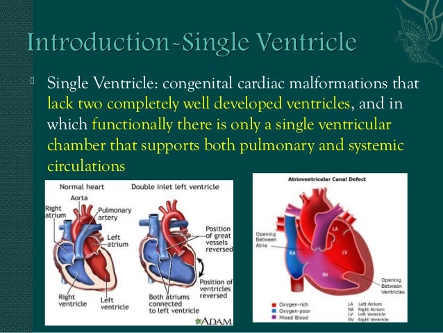 Single ventricle dr. prashant medanta