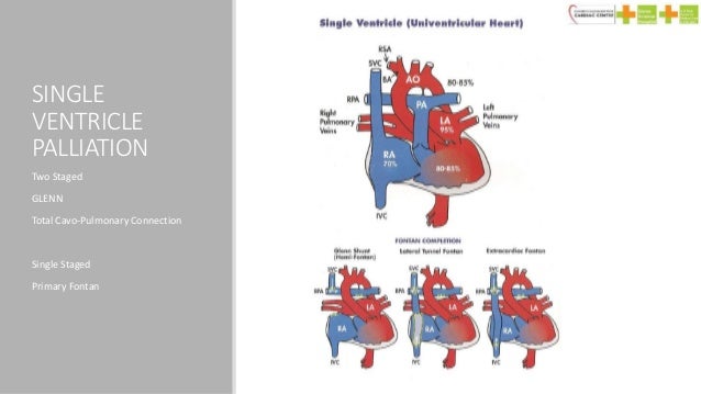 Single ventricle palliation