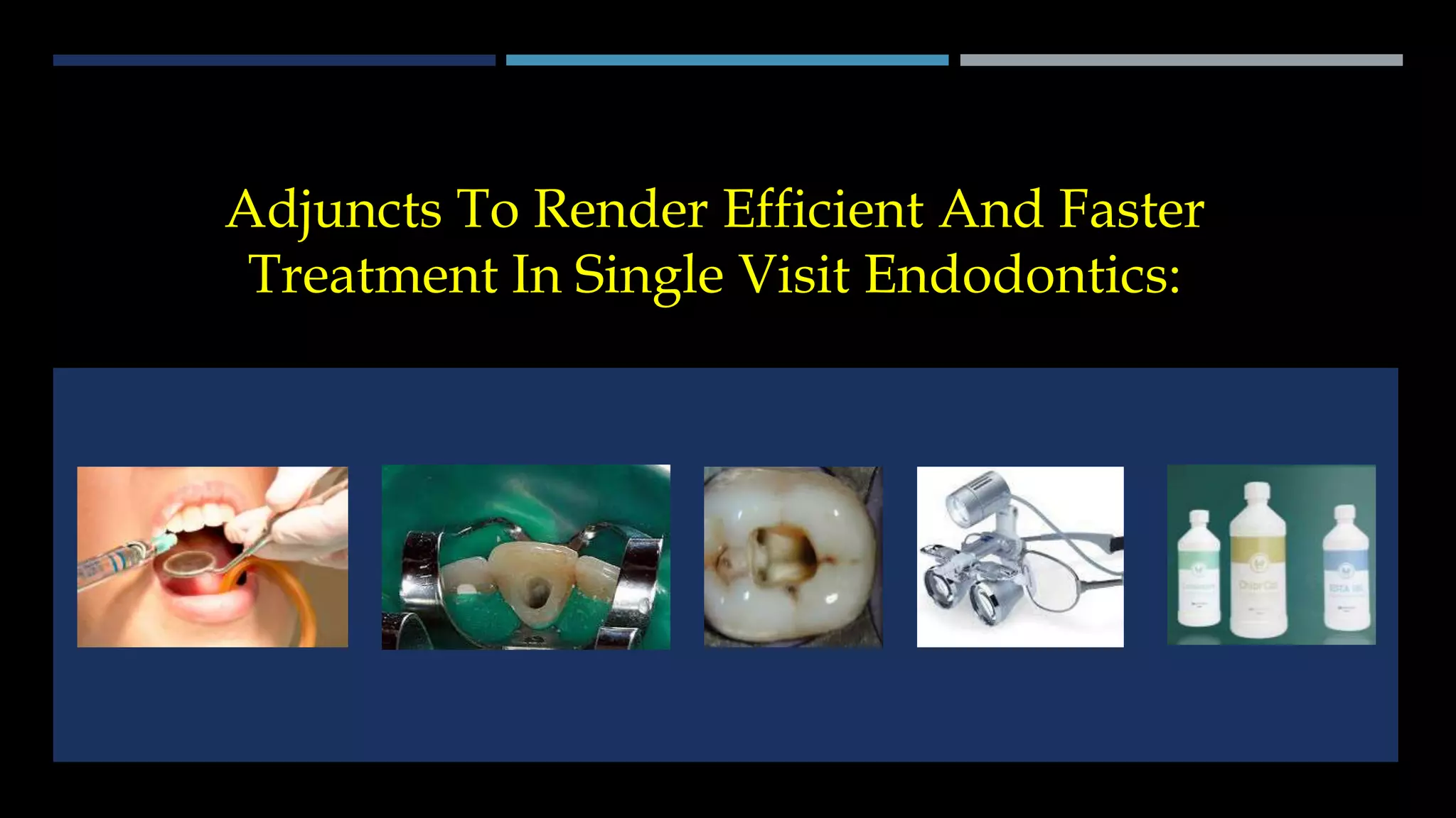 Single visit endodontics | PPTX