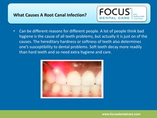Single Visit Root Canal Treatment - Affordable Dentistry Services in ...