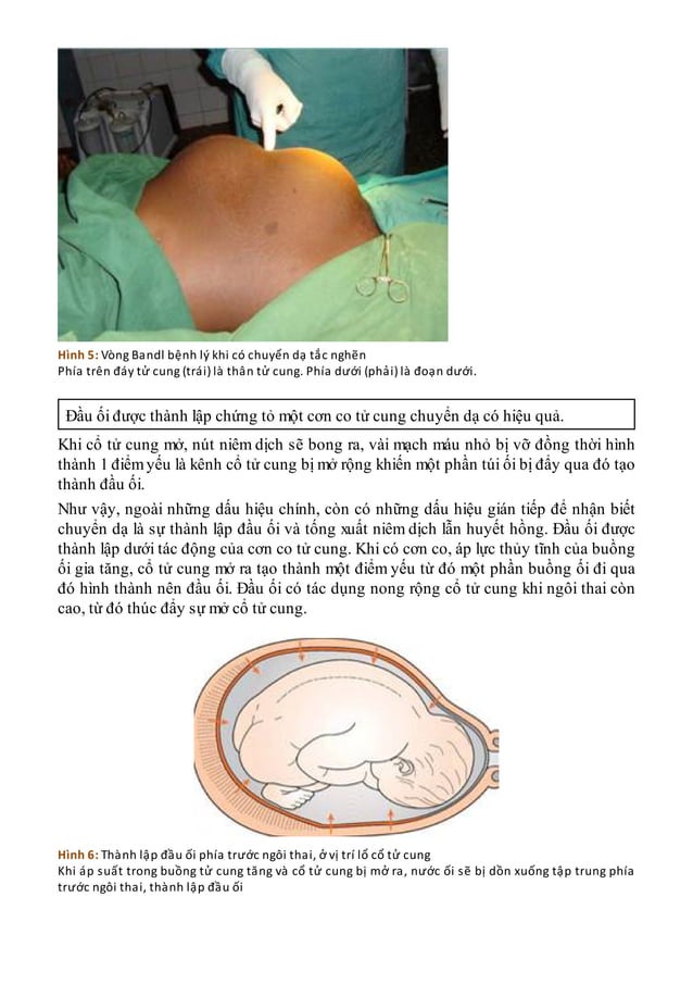 SINH LÝ CHUYỂN DẠ | PDF