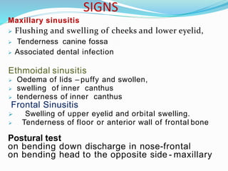 sinisitis.pptx