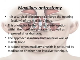Nursing management of patient withSINISITIS | PPTX