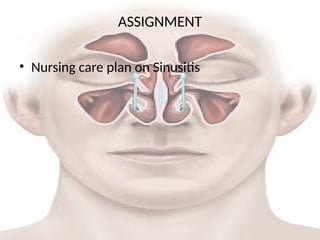 Nursing management of patient withSINISITIS | PPTX