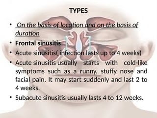 Nursing management of patient withSINISITIS | PPTX