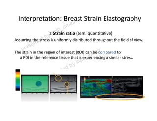 Strain Elastography for Breast | PPT