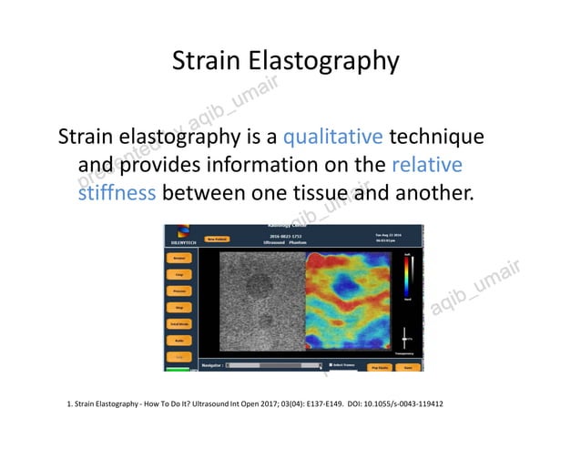 Strain Elastography for Breast | PDF