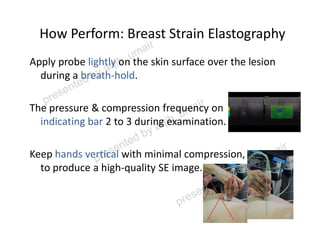 Strain Elastography for Breast | PDF