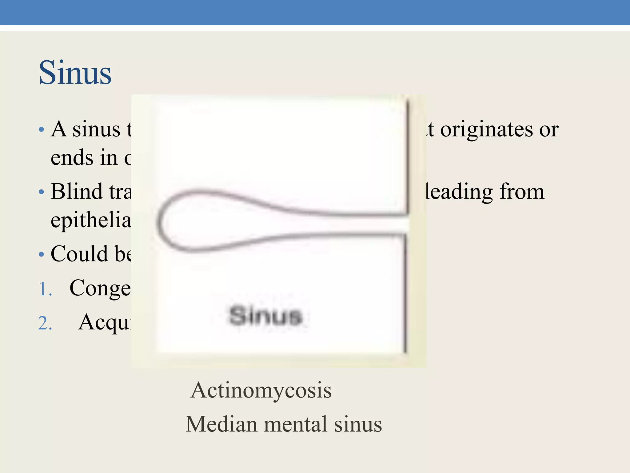 Sinogram and fistulogram | PPTX