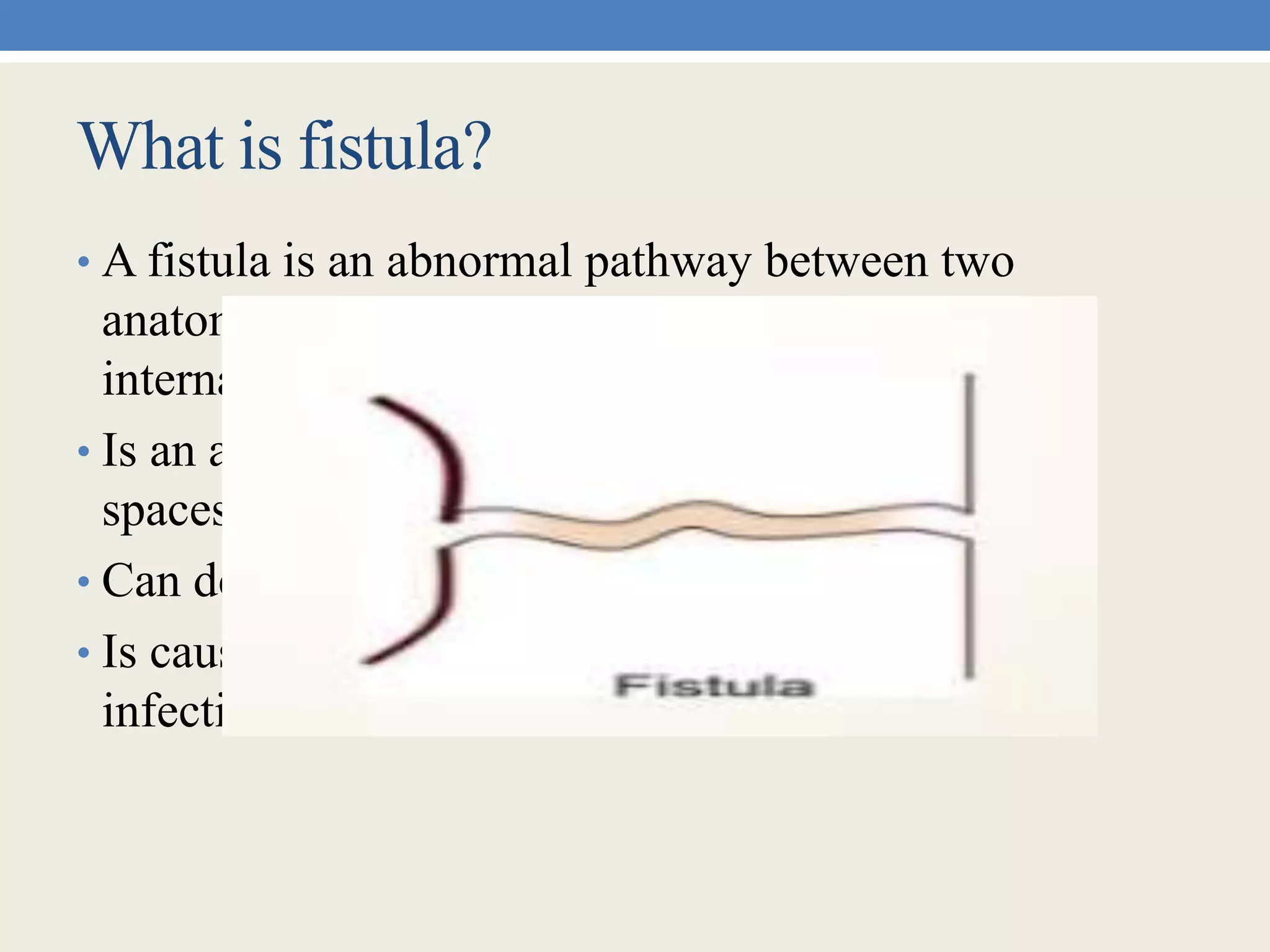 Sinogram and fistulogram | PPTX