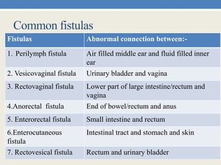 Sinogram and fistulogram | PPTX