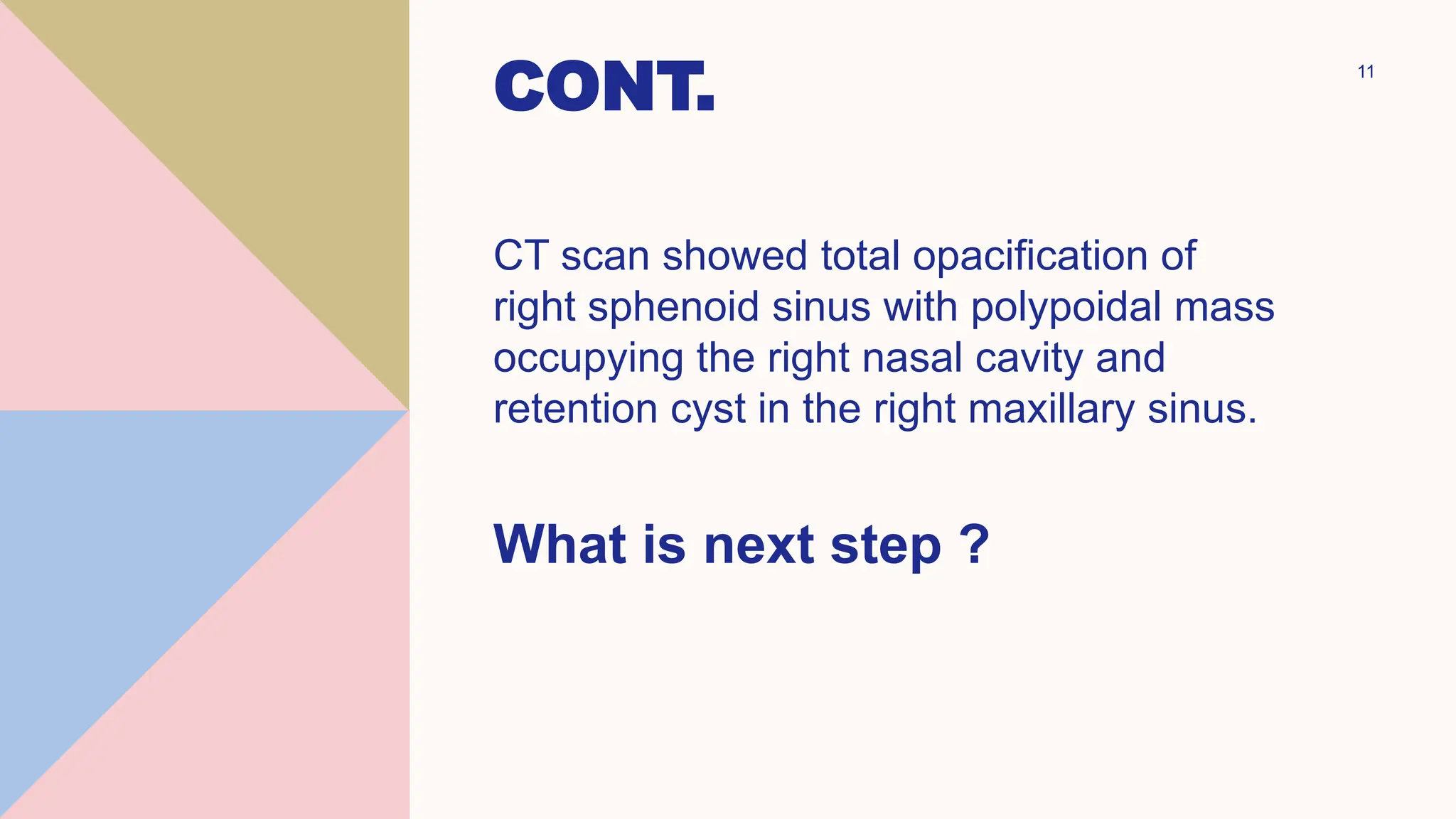 Sinonasal Malignancy.pptx