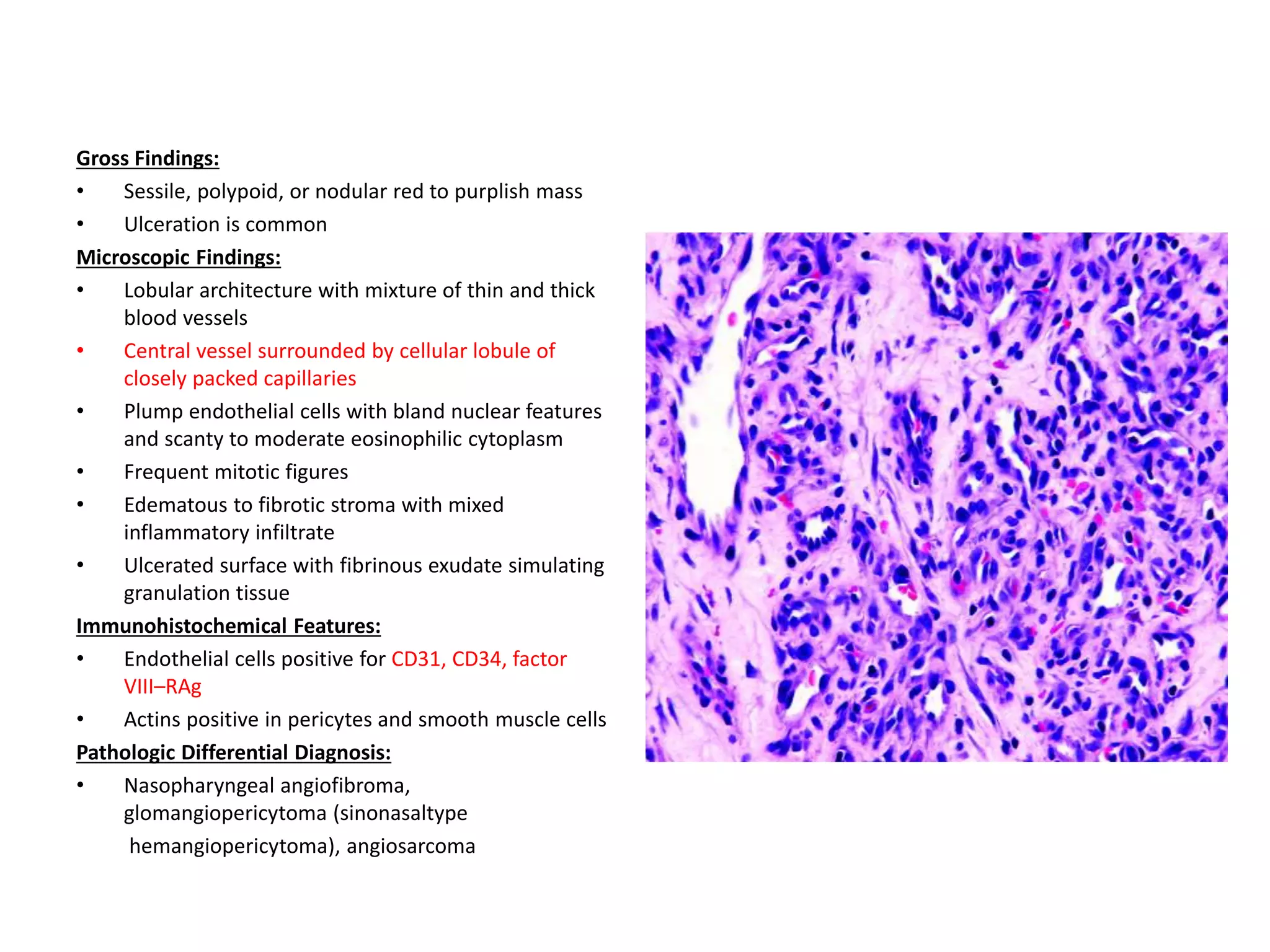 Sinonasal tract pathology(histopathology) | PPTX