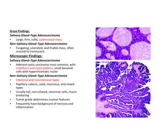 Sinonasal tract pathology(histopathology) | PPTX