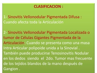 Sinovitis vellonodular pigmentada | PPTX
