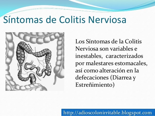 Colitis Nerviosa Sintomas